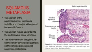 cardiac hypertrophy & CIN dysplasia metaplasia .pptx