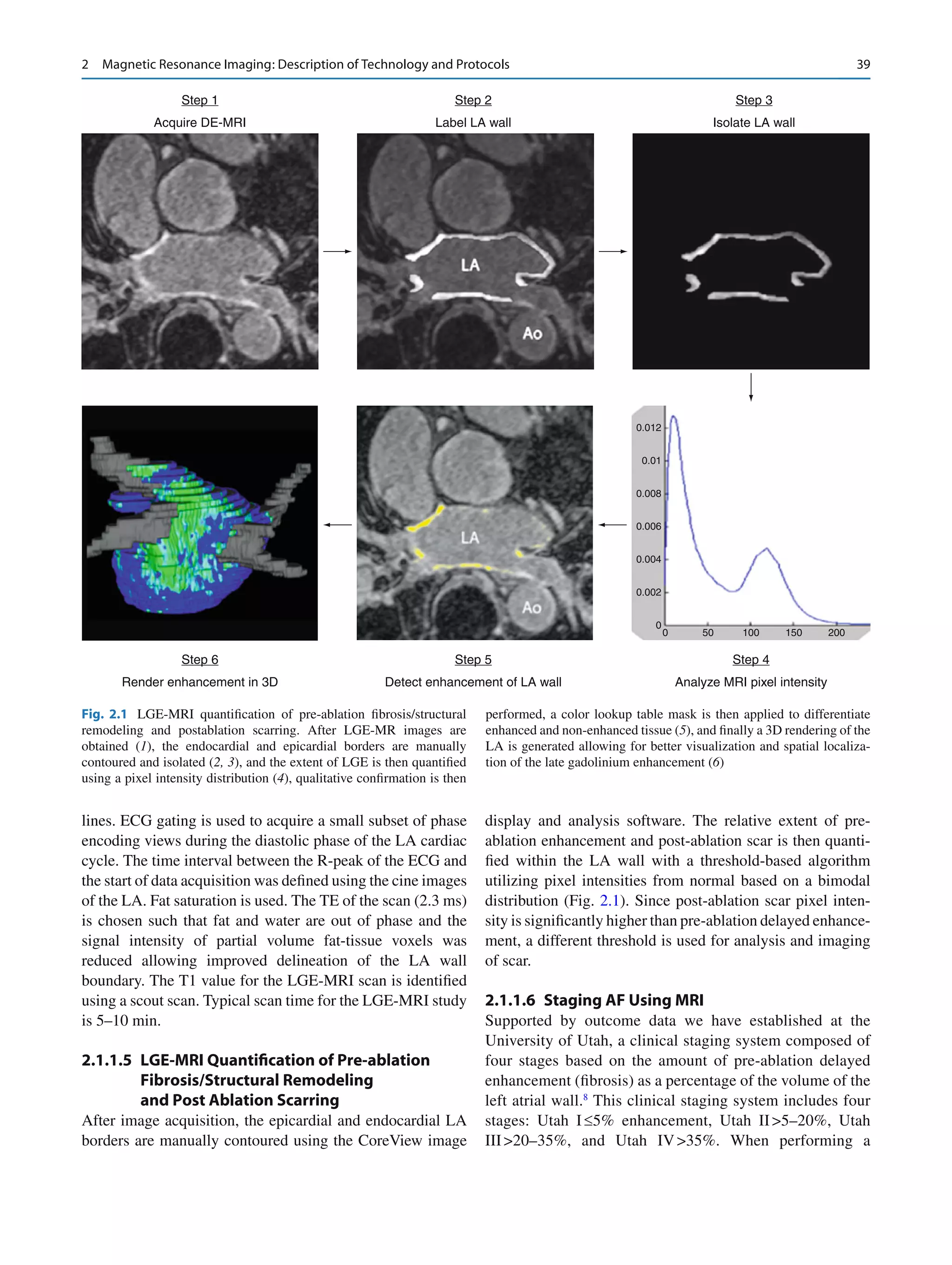 Cardiac imaging in electrophysiology | PDF