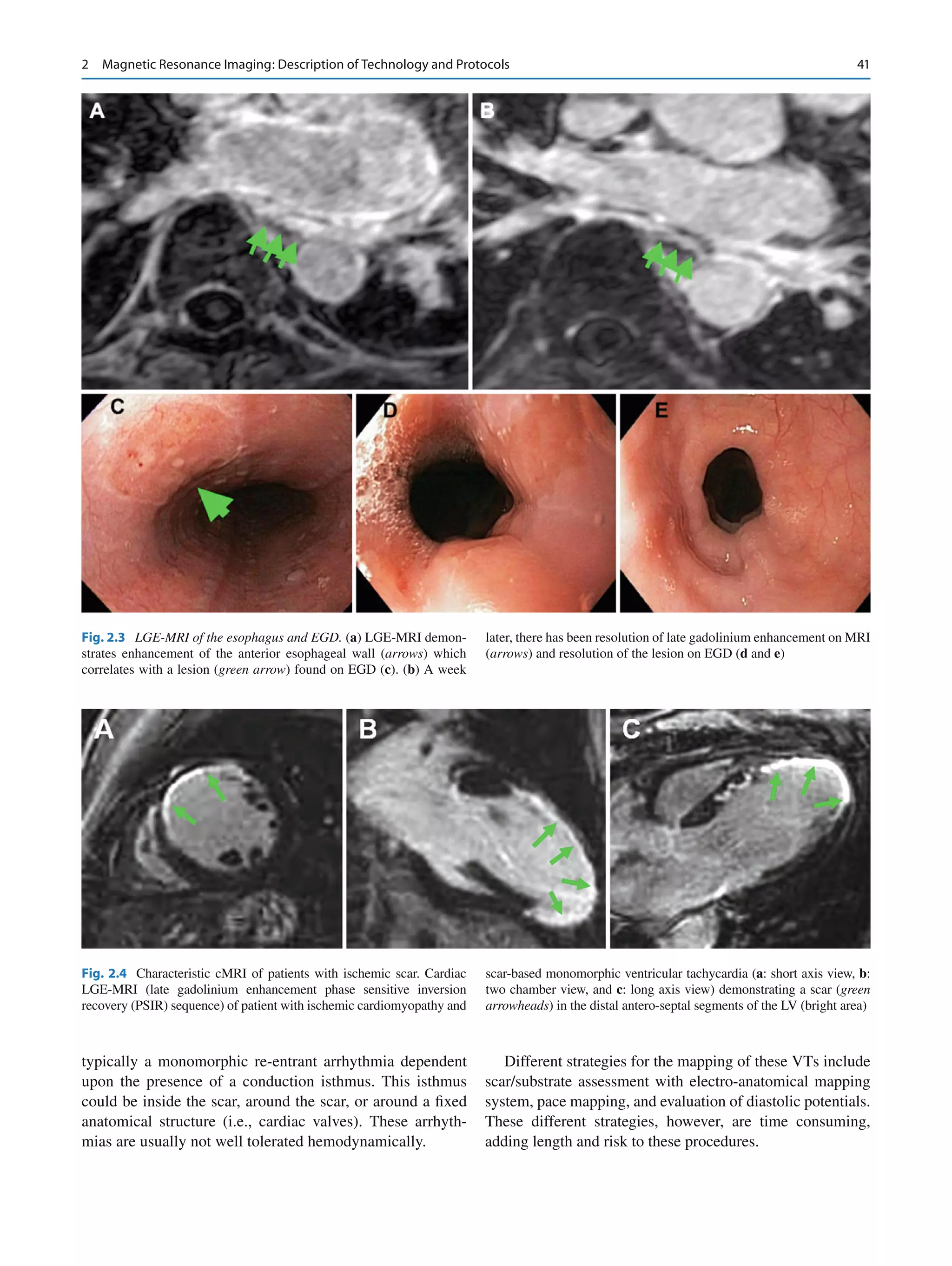 Cardiac imaging in electrophysiology | PDF