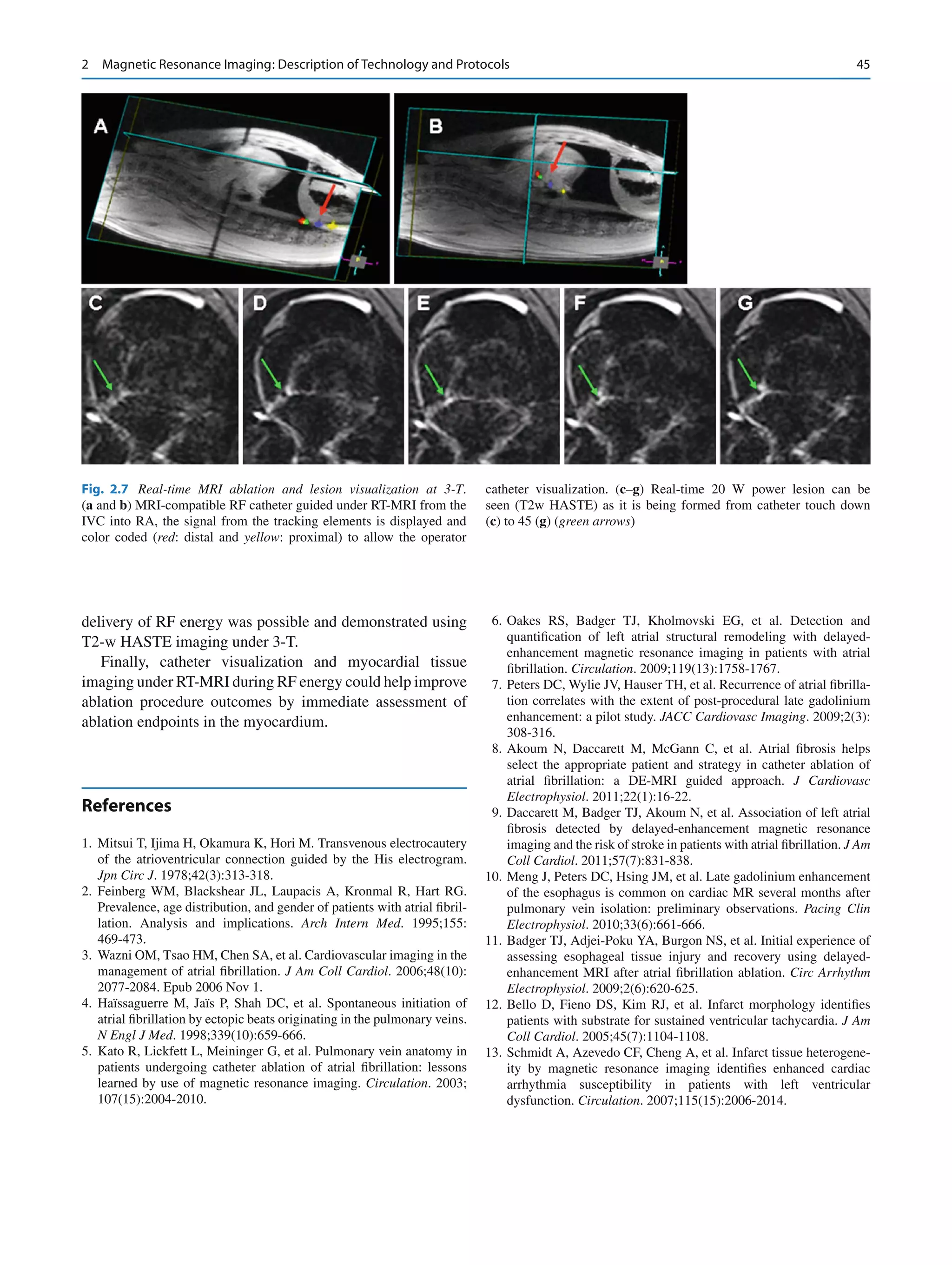 Cardiac imaging in electrophysiology | PDF