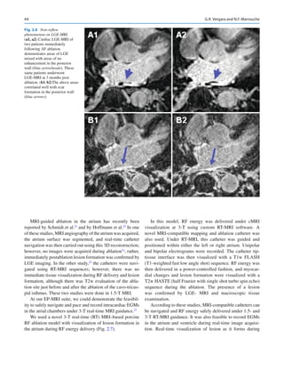 Cardiac imaging in electrophysiology | PDF