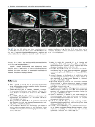 Cardiac imaging in electrophysiology | PDF