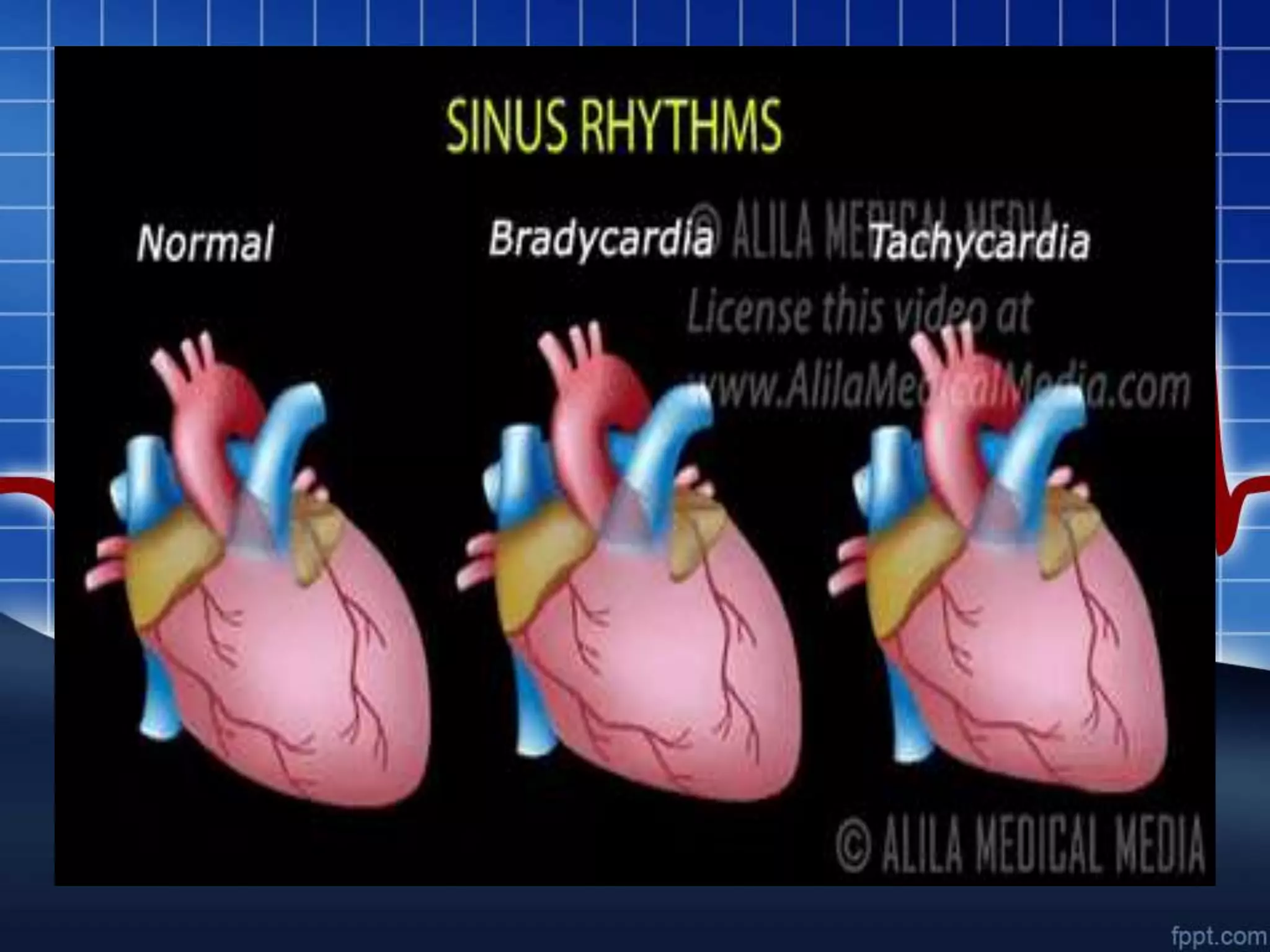 Generation and conduction of Cardiac impulse | PPT