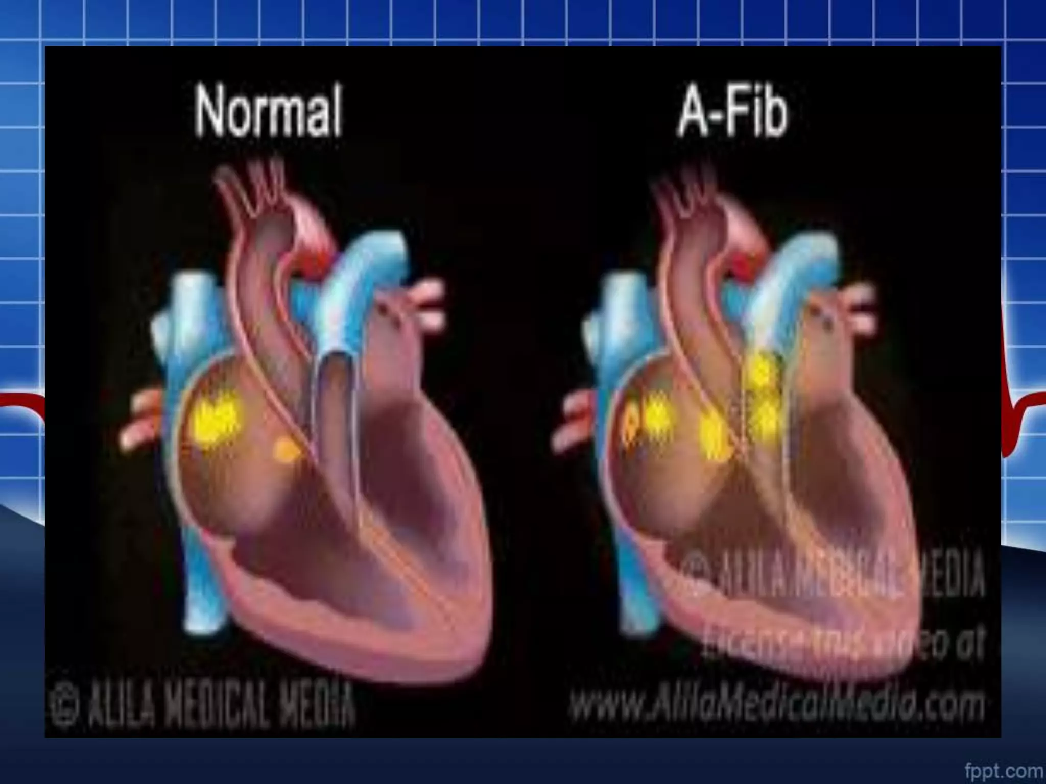Generation and conduction of Cardiac impulse | PPT