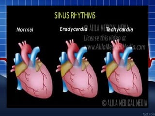Generation and conduction of Cardiac impulse | PPT