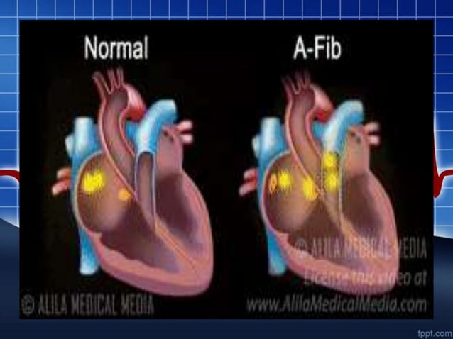 Generation and conduction of Cardiac impulse | PPT