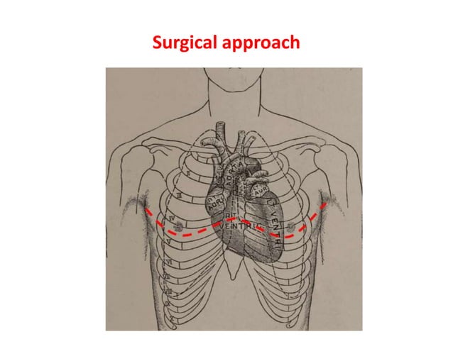 Cardiac injuries copy | PPTX