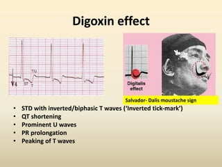 CARDIAC INOTROPES - DR SANDEEP MOHANAN.ppsx