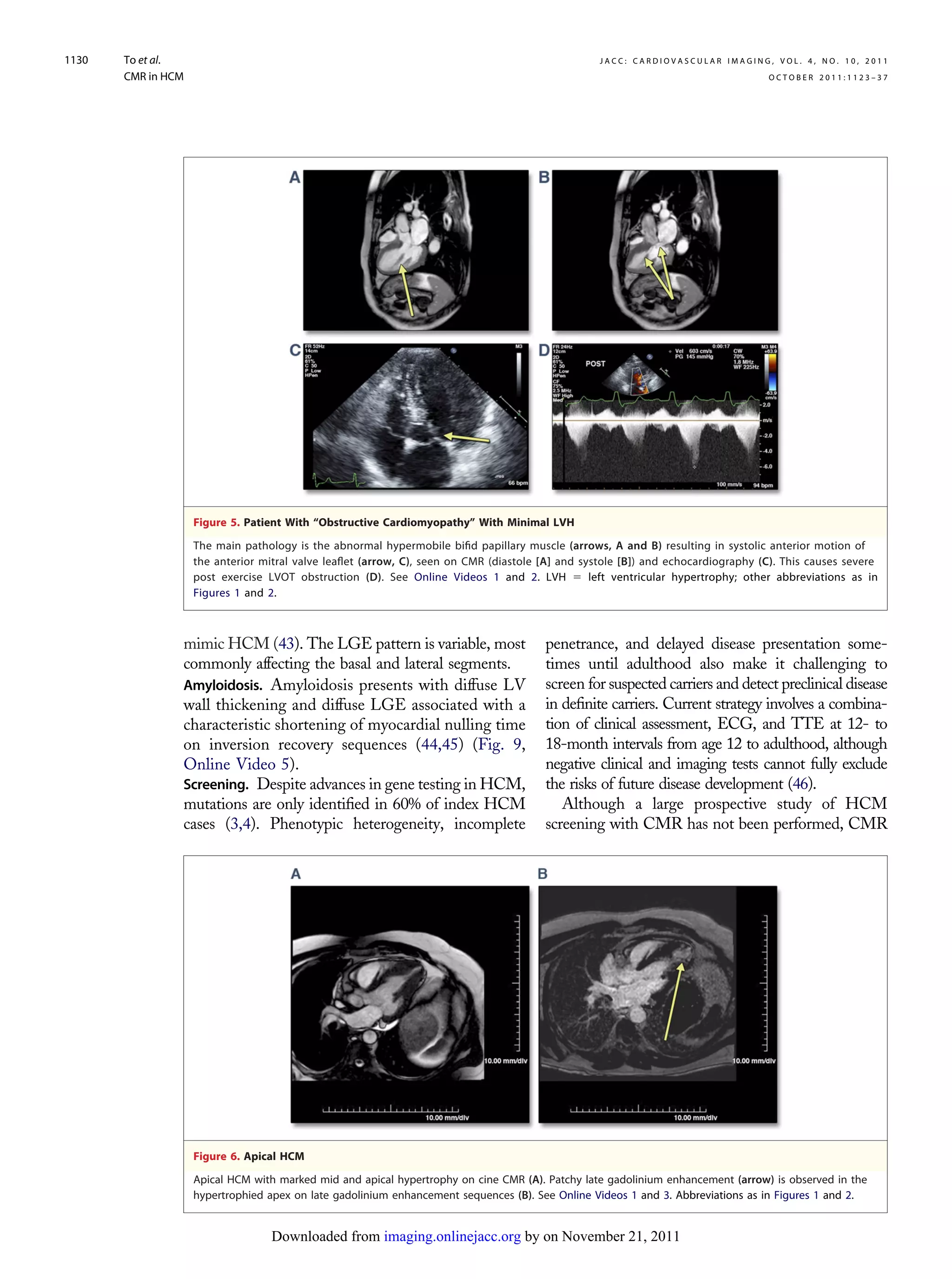 Cardiac MRI in hypertrophic cardiomyopathy | PDF