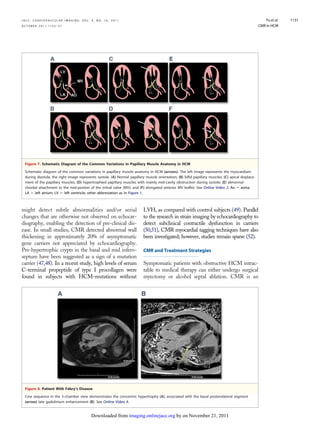 Cardiac MRI in hypertrophic cardiomyopathy | PDF