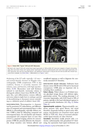 Cardiac MRI in hypertrophic cardiomyopathy | PDF