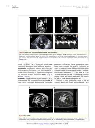 Cardiac MRI in hypertrophic cardiomyopathy | PDF