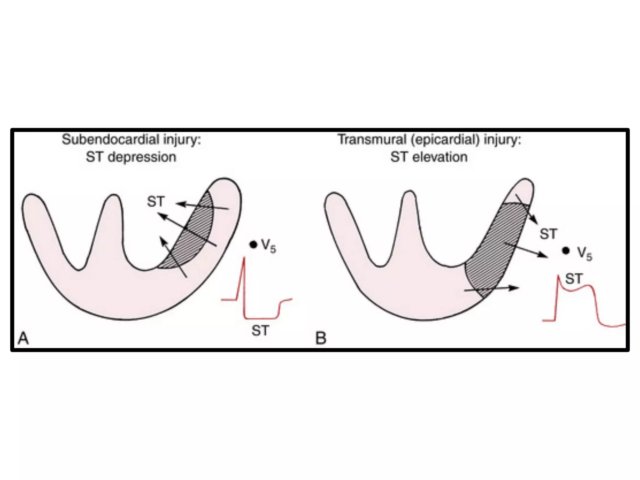 Cardiac markers | PDF