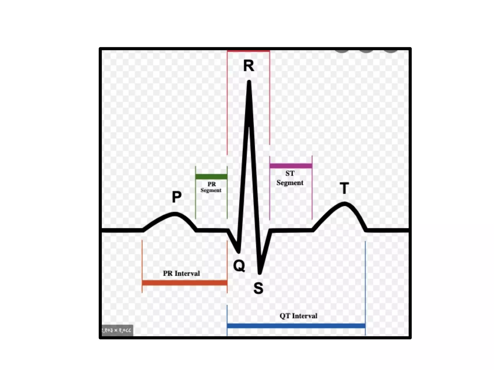 Cardiac markers | PDF