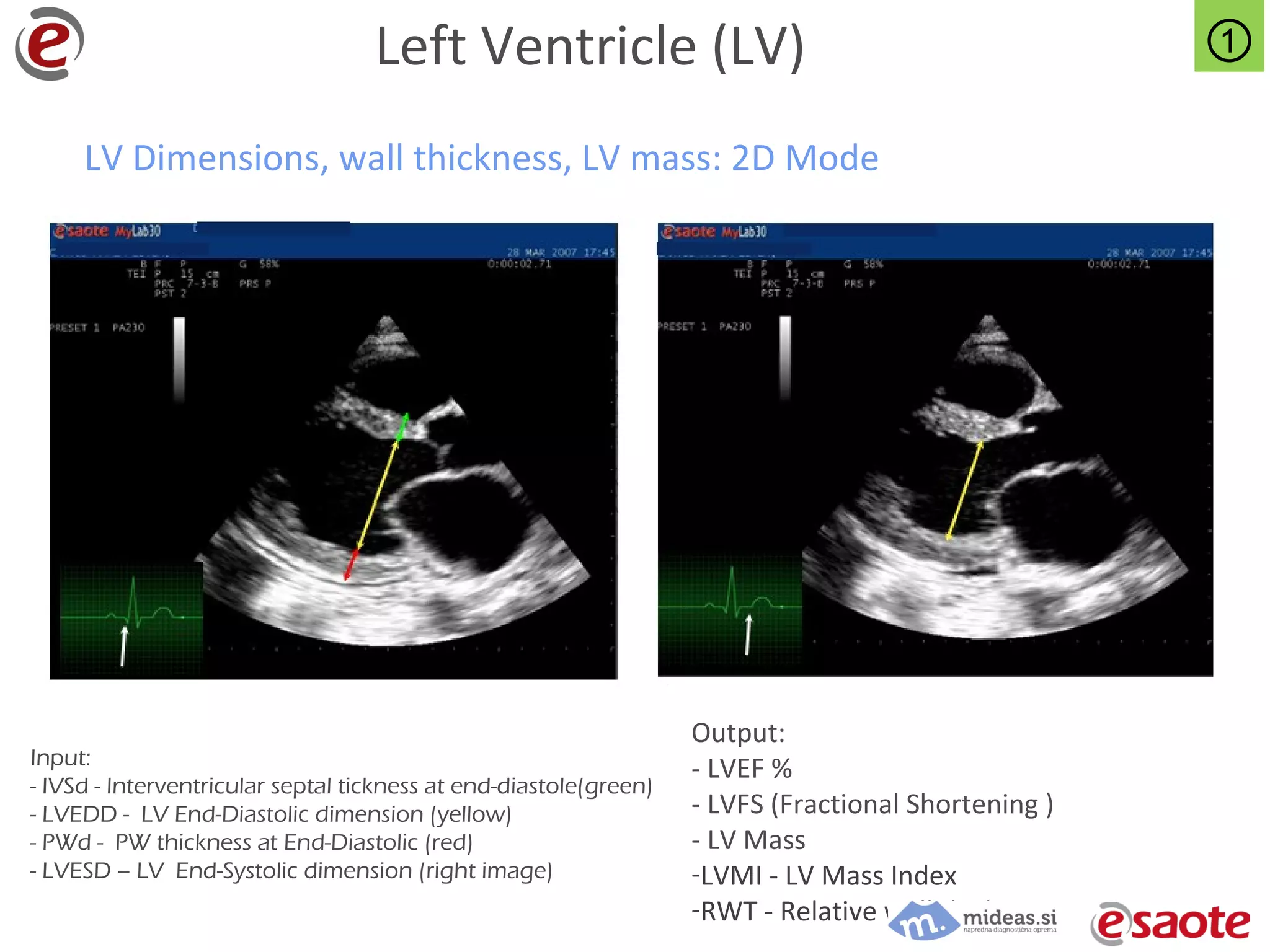 Cardiacmeasurementsguidelinesesaotemideas 140324014158-phpapp02 | PDF