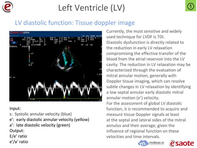 Cardiacmeasurementsguidelinesesaotemideas 140324014158-phpapp02 | PDF