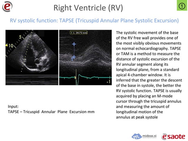 Cardiacmeasurementsguidelinesesaotemideas 140324014158-phpapp02 | PDF