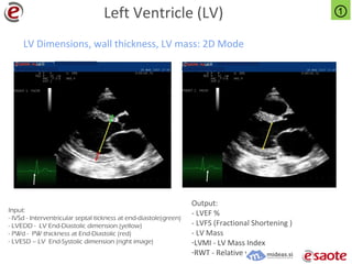 Cardiacmeasurementsguidelinesesaotemideas 140324014158-phpapp02 | PDF