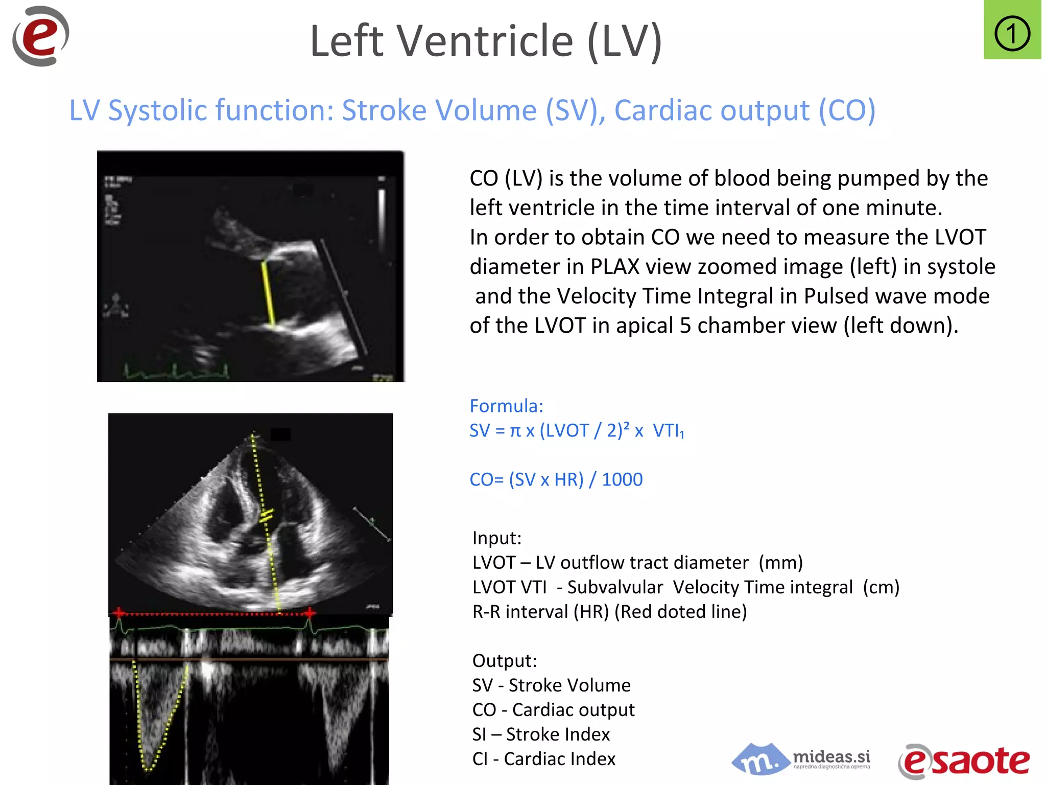 Cardiac Measurements Guidelines | powered by Esaote | PPT