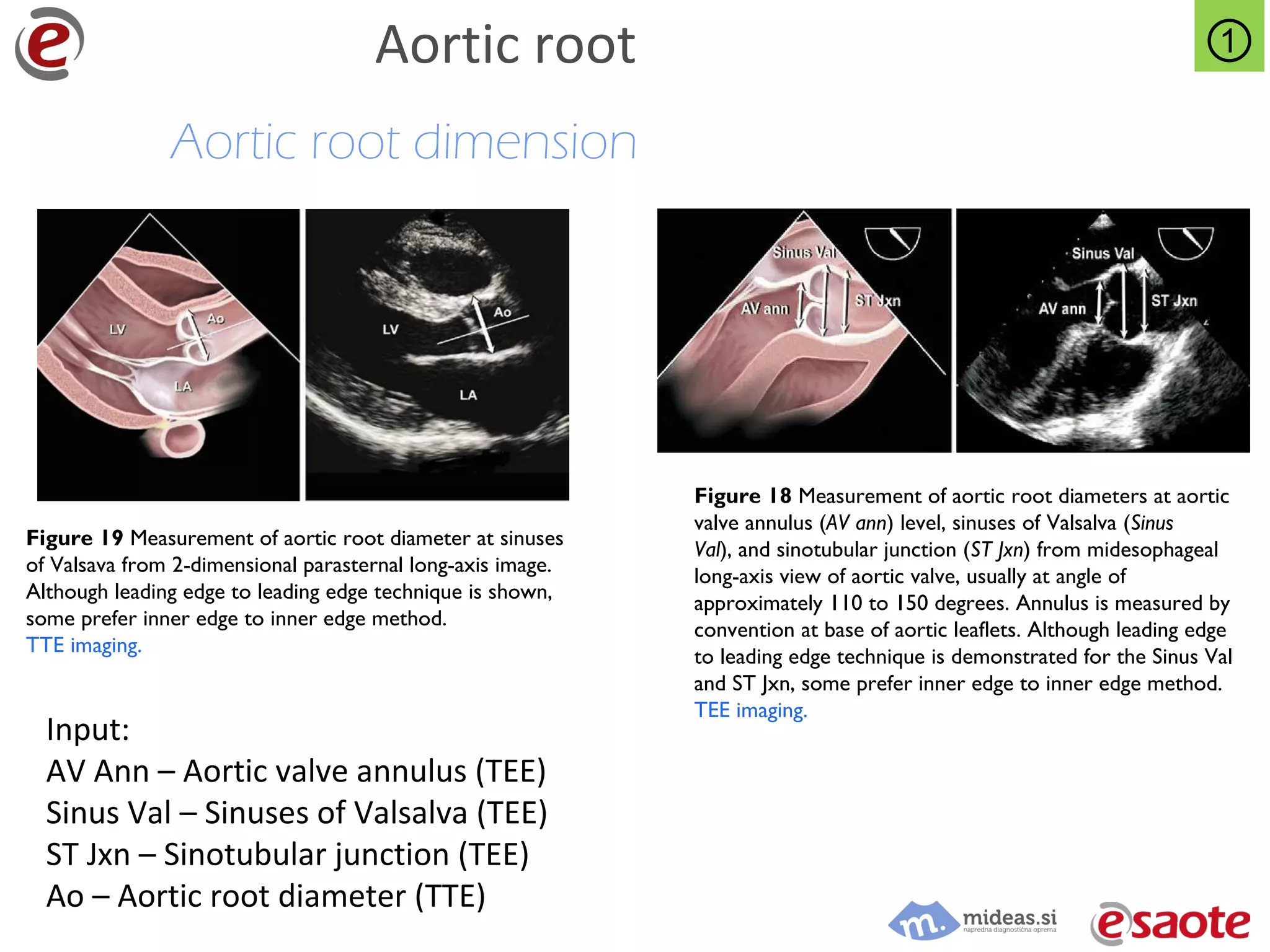 Cardiac Measurements Guidelines | powered by Esaote | PPT