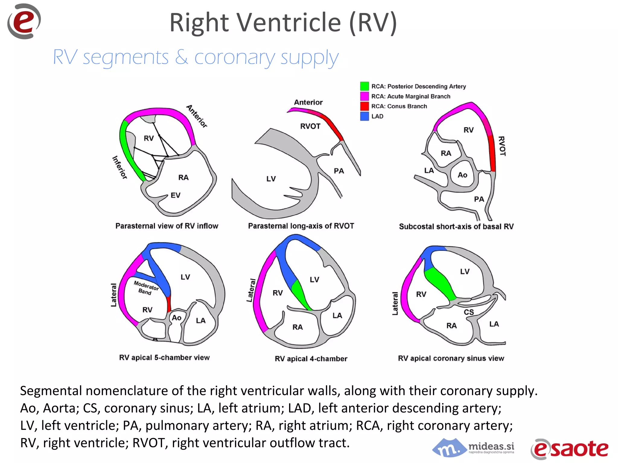 Cardiac Measurements Guidelines | powered by Esaote | PPT | Heart and ...