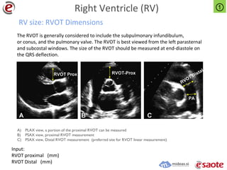 Cardiac Measurements Guidelines | powered by Esaote | PPT