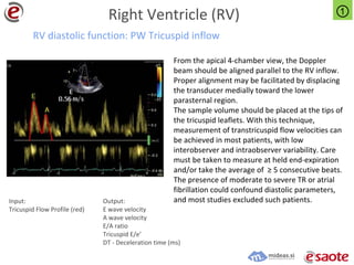 Cardiac Measurements Guidelines | powered by Esaote | PPT