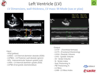 Cardiac Measurements Guidelines | powered by Esaote | PPT