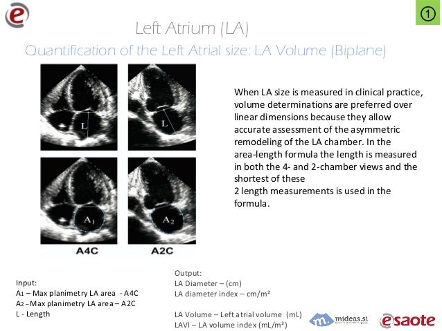 Cardiac Measurements Guidelines | powered by Esaote