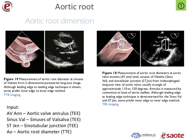 Cardiac Measurements Guidelines | powered by Esaote