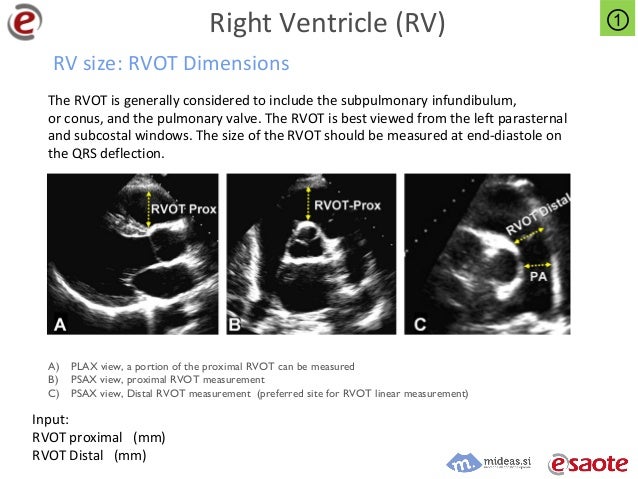Cardiac Measurements Guidelines | powered by Esaote