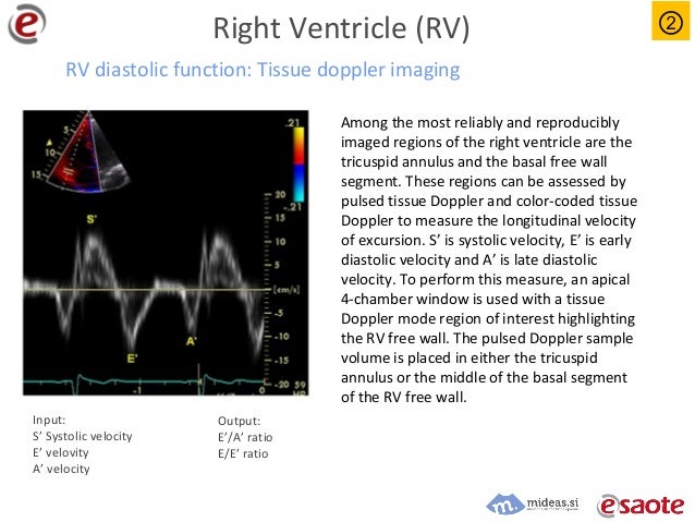 Cardiac Measurements Guidelines | powered by Esaote