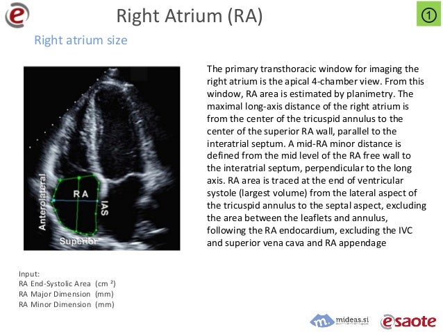 Cardiac Measurements Guidelines | powered by Esaote