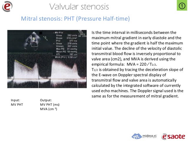 Cardiac Measurements Guidelines | powered by Esaote