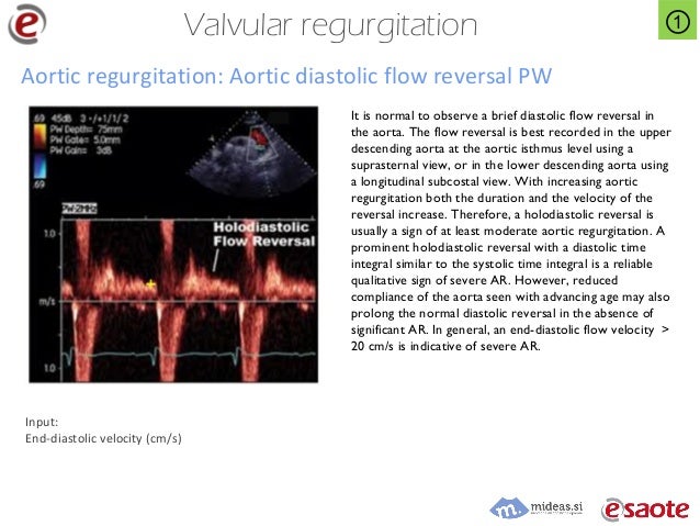 Cardiac Measurements Guidelines | powered by Esaote