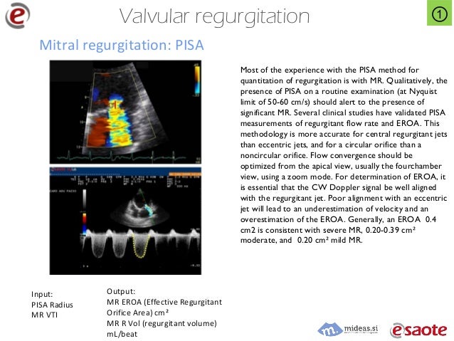 Cardiac Measurements Guidelines | powered by Esaote