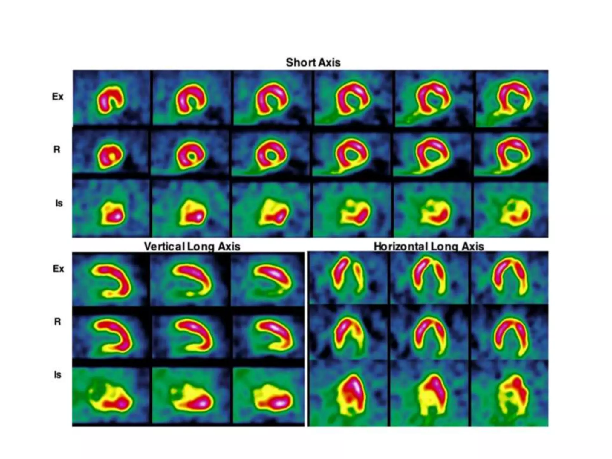 Cardiac metabolic imaging | PPT