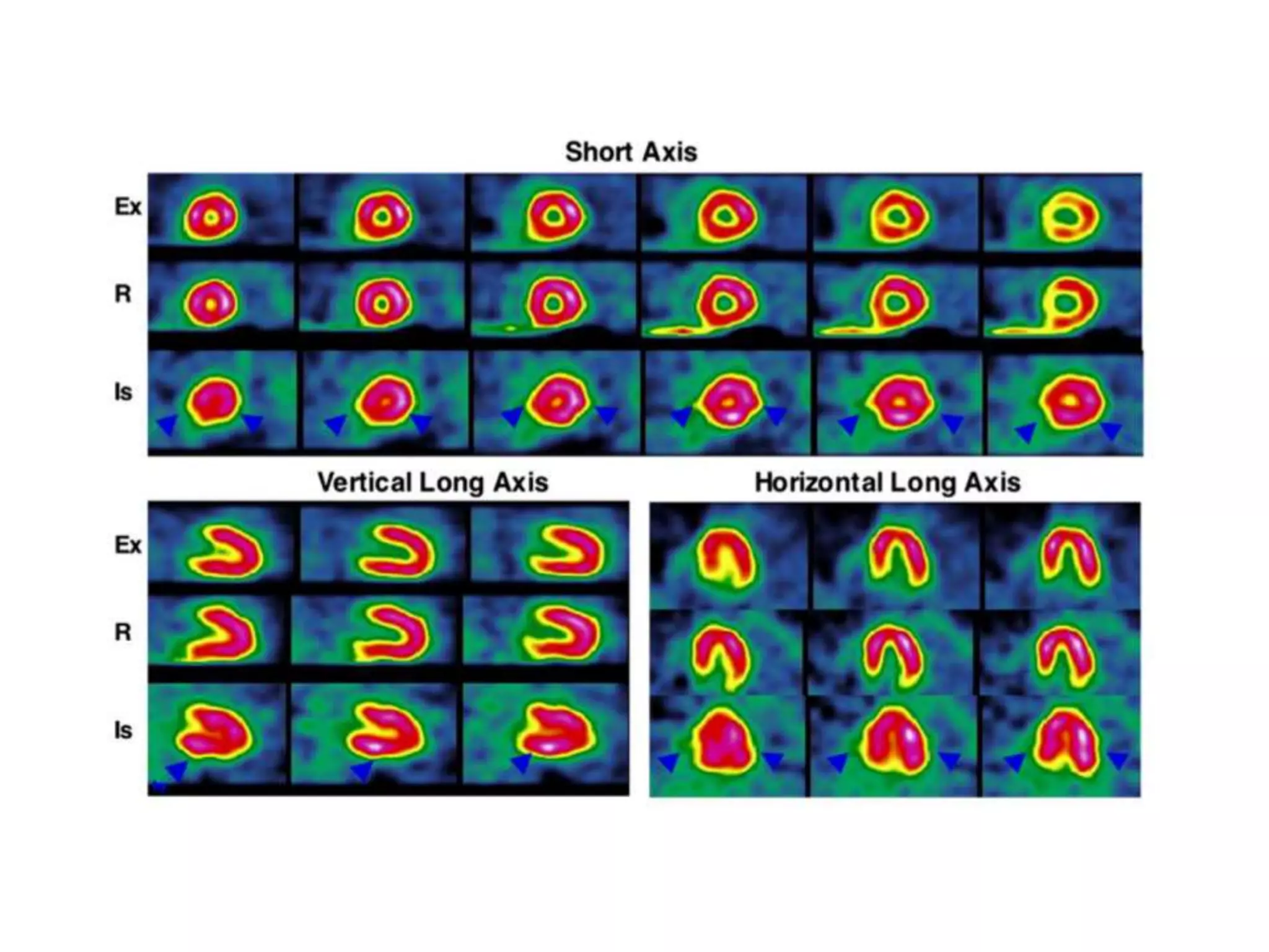 Cardiac metabolic imaging | PPT