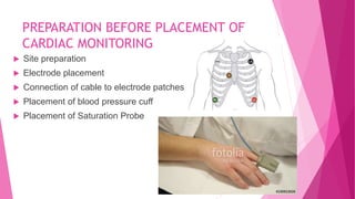 Presentation on Cardiac monitoring | PPTX