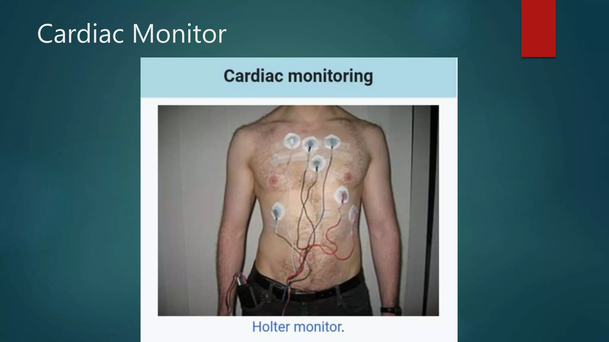 Cardiac monitoring(presentation ) for medical students | PPTX