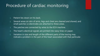 Cardiac monitoring(presentation ) for medical students | PPTX