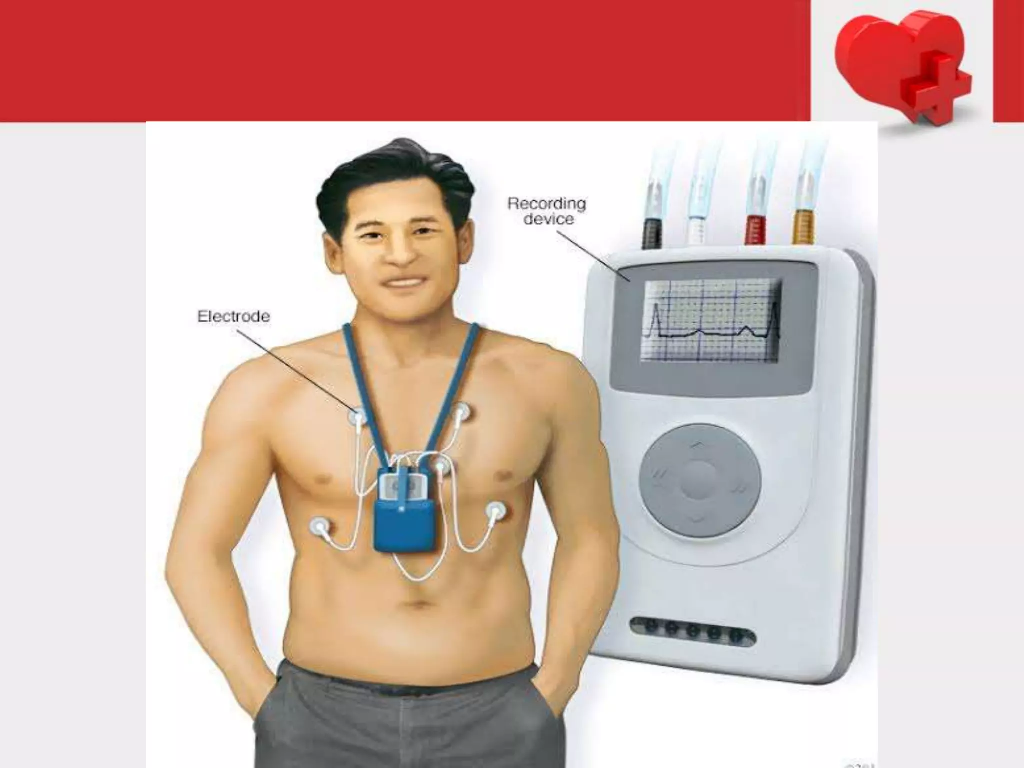 CARDIAC MONITORING.pptx