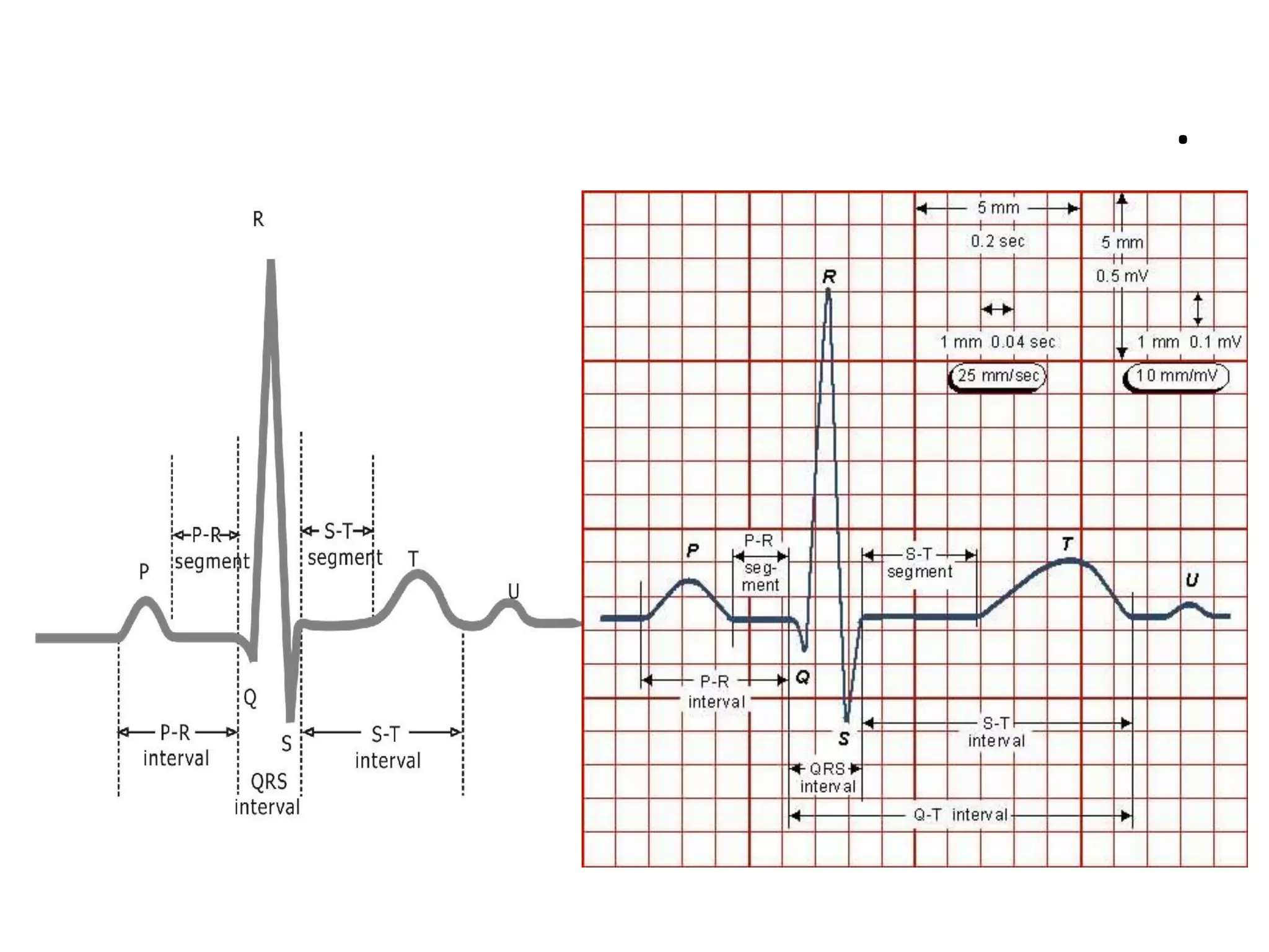 Cardiac monitoring.pdf