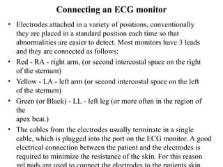Cardiac monitoring. presentaation in detailed | PPTX