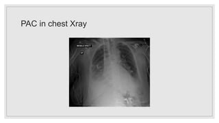 Cardiovascular monitoring final ppt.pptx