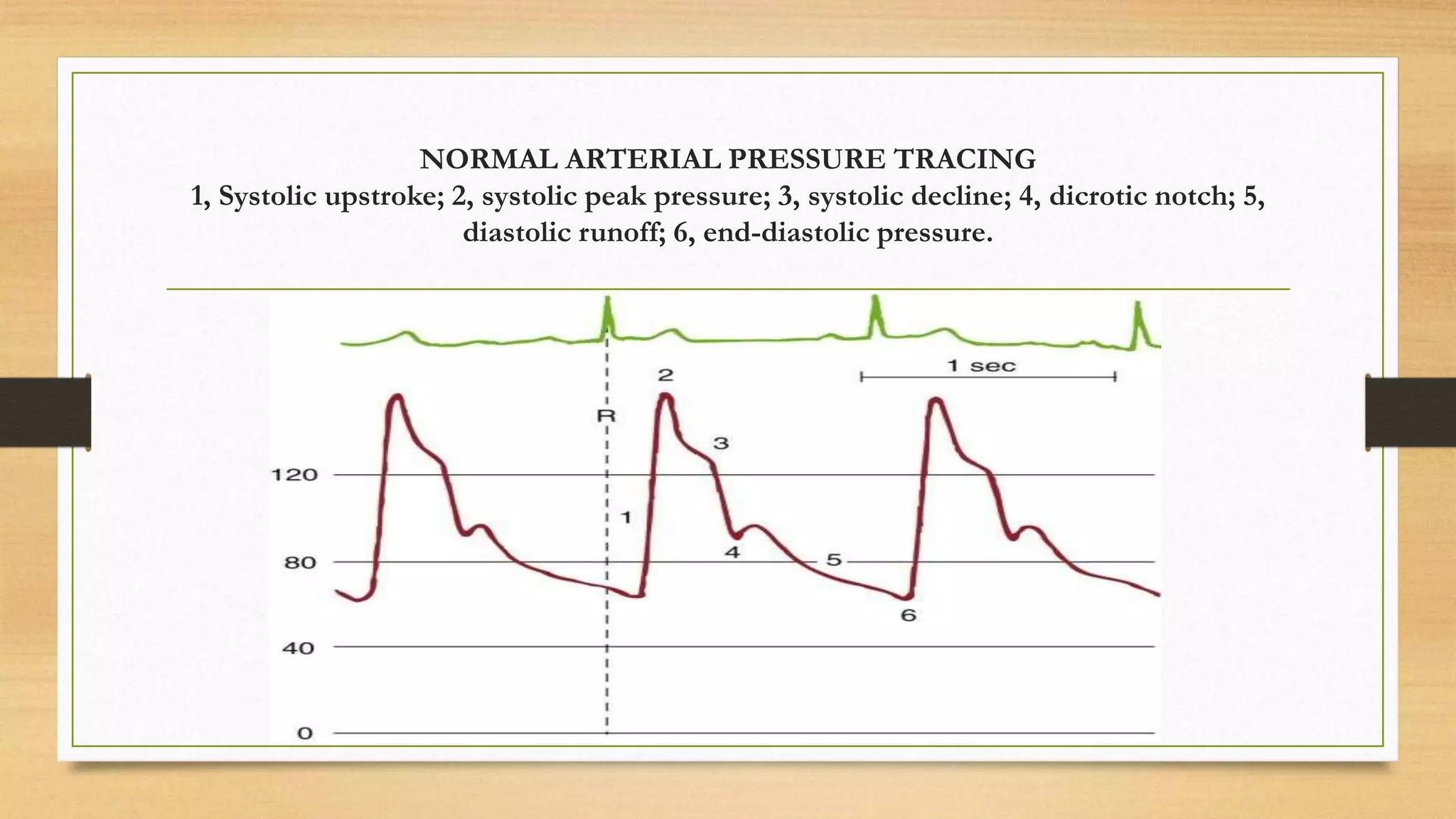 Cardiac monitoring ppt | PPTX