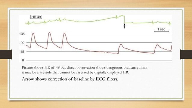 Cardiac monitoring ppt | PPTX