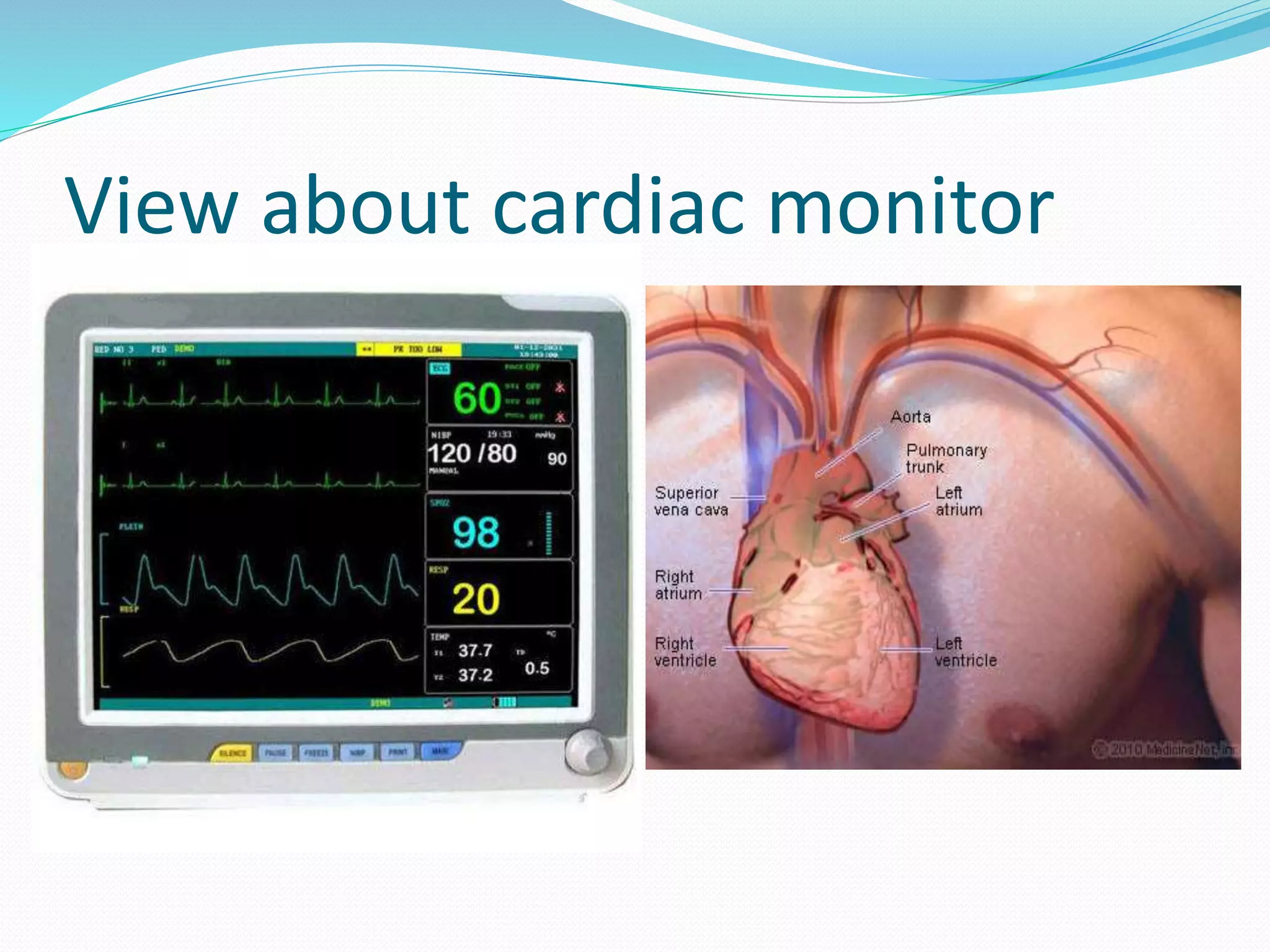 Cardiac monitor ppt | PPTX
