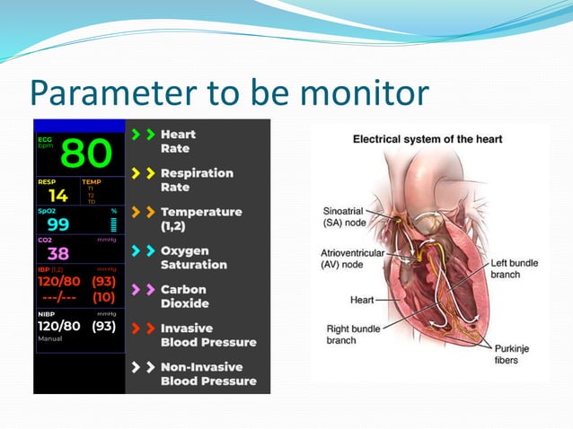 Cardiac monitor ppt | PPTX | Heart and Cardiovascular Diseases ...