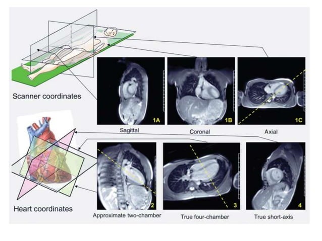 Cardiac mri | PPTX | Heart and Cardiovascular Diseases | Diseases and ...